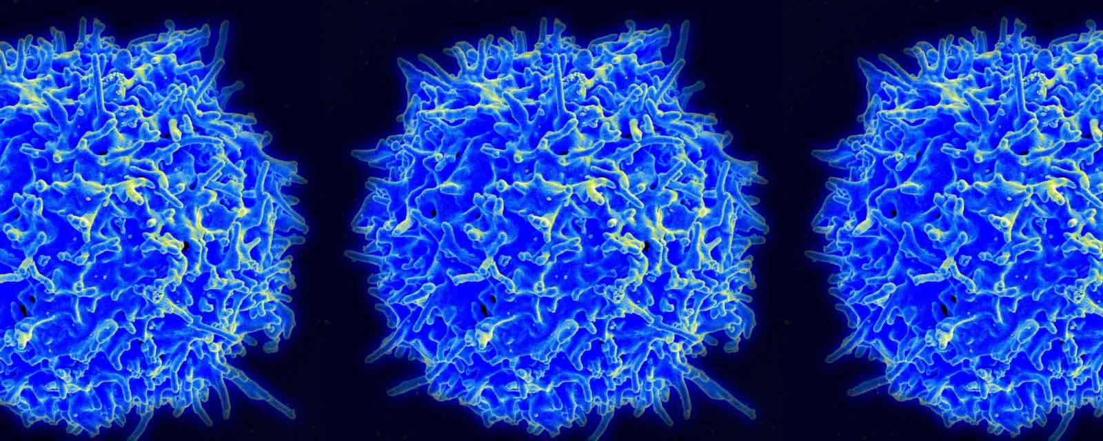 The Evolution of Cell Therapy Manufacturing - Early Days and Present ...